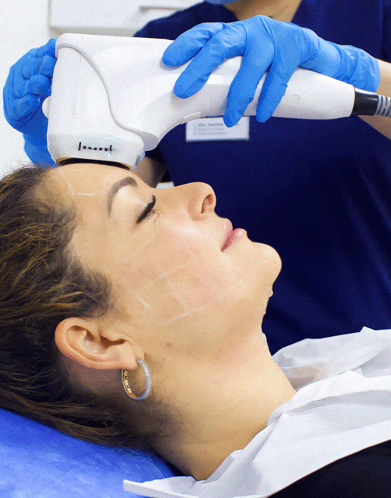 Hifu 4D Facial | Dermafemm Clinic®
