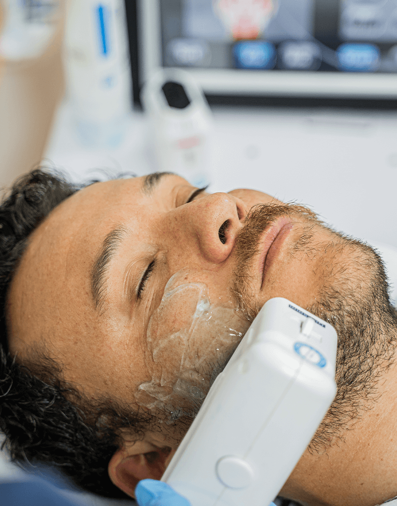 Hifu 4D Facial | Dermafemm Clinic®