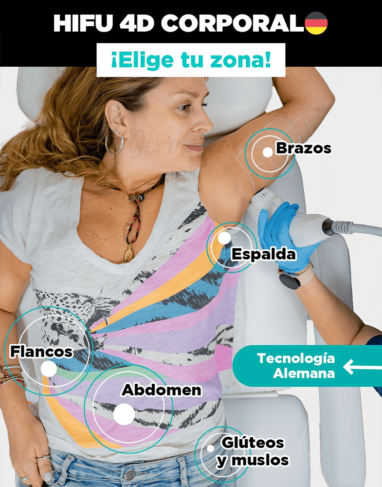 Hifu 4D Corporal | Dermafemm Clinic®